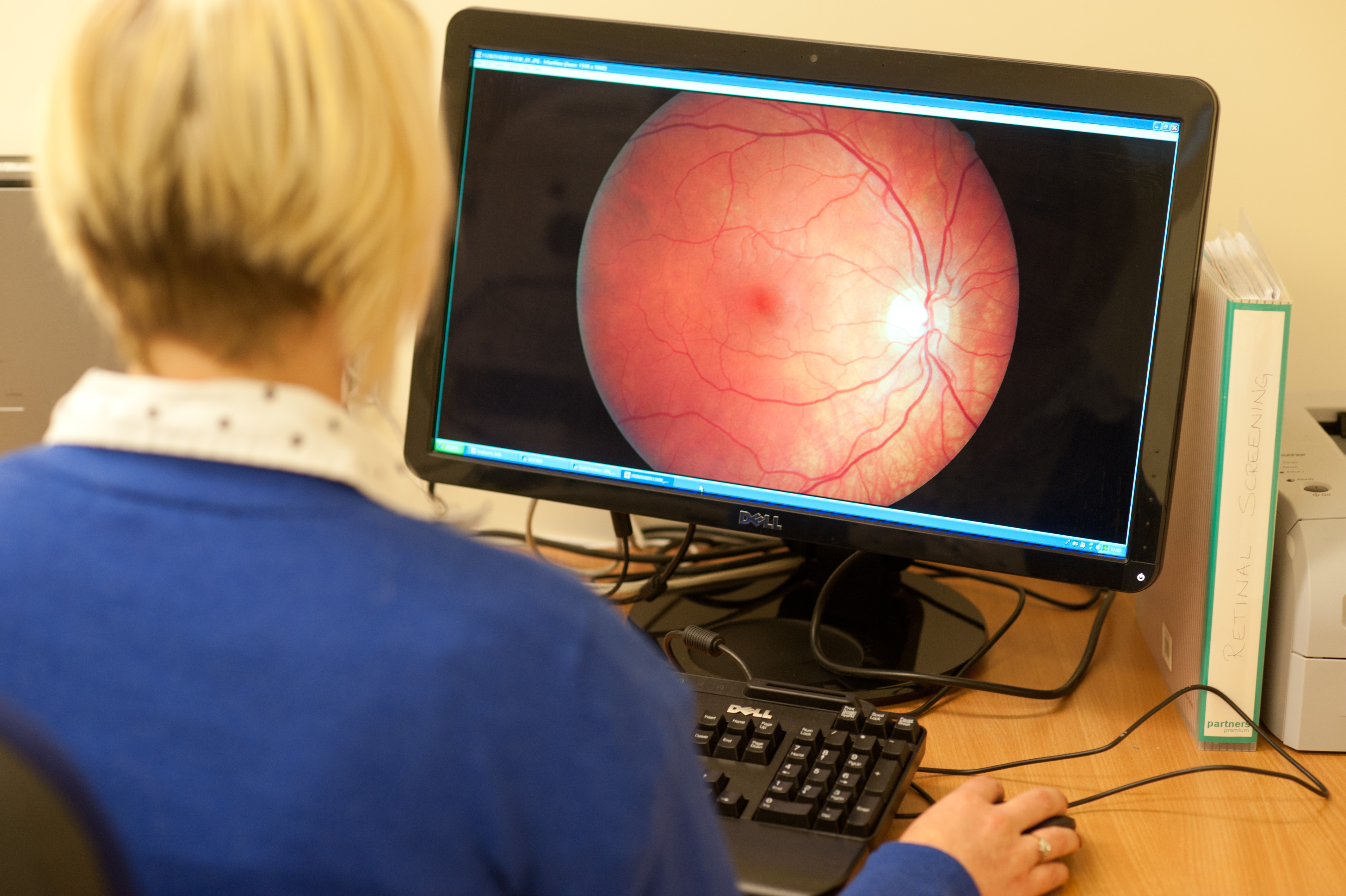 New Reports Will Help Improve Grading Of Diabetic Eye Screening Images New Reports Will Help Improve Grading Of Diabetic Eye Screening Images