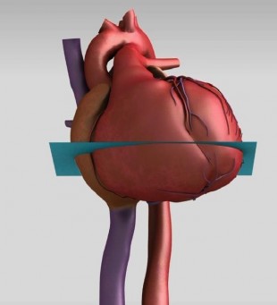 New virtual view learning for ultrasonographers – PHE Screening