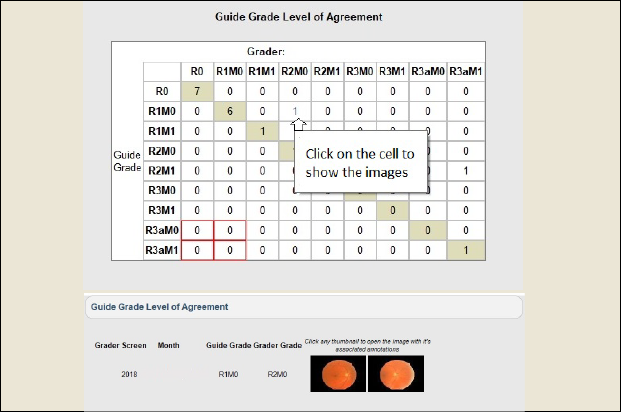 New report to quality assure national grading in diabetic eye screening ...