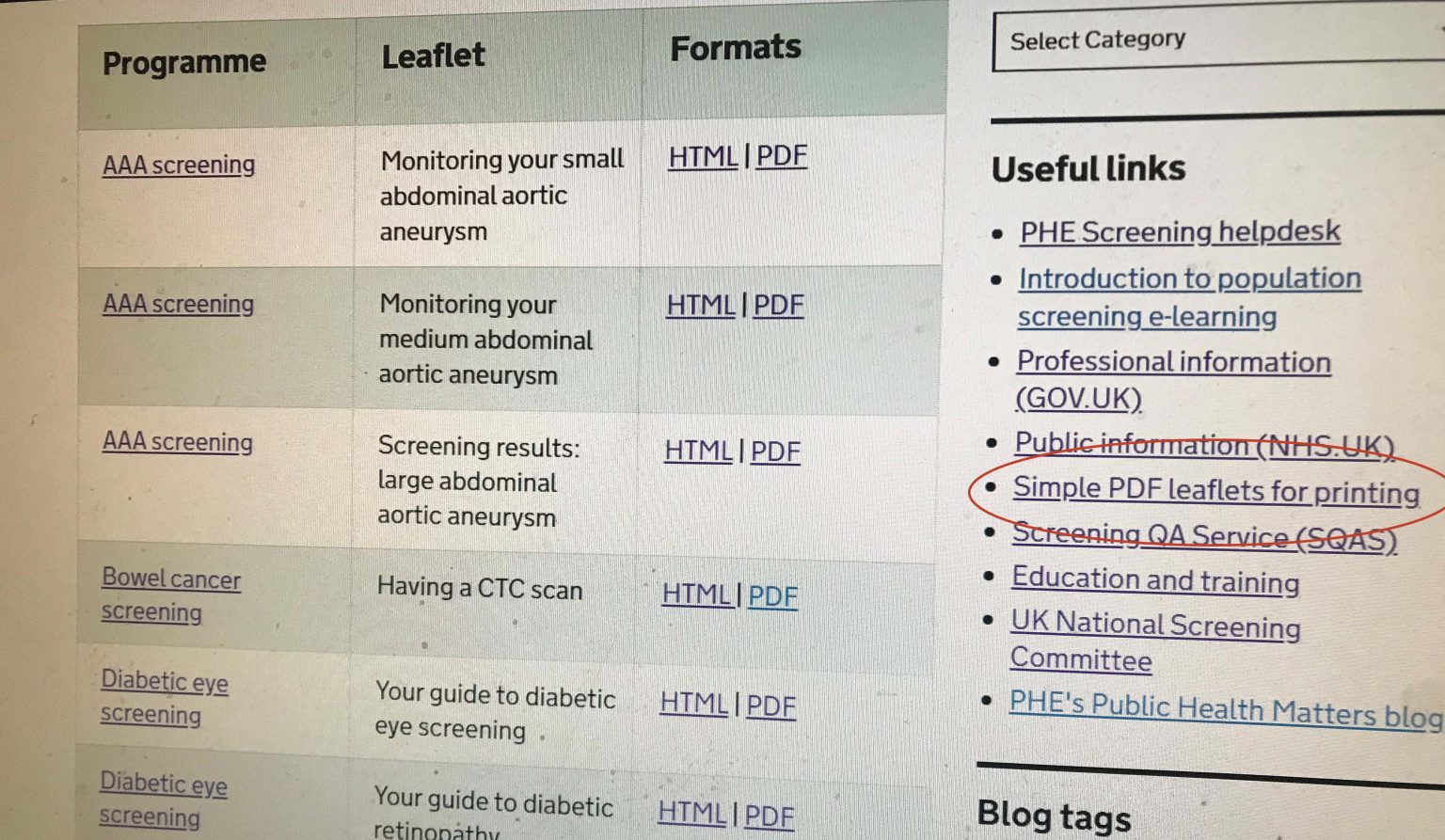 NHS Abdominal Aortic Aneurysm Screening Programme – PHE Screening
