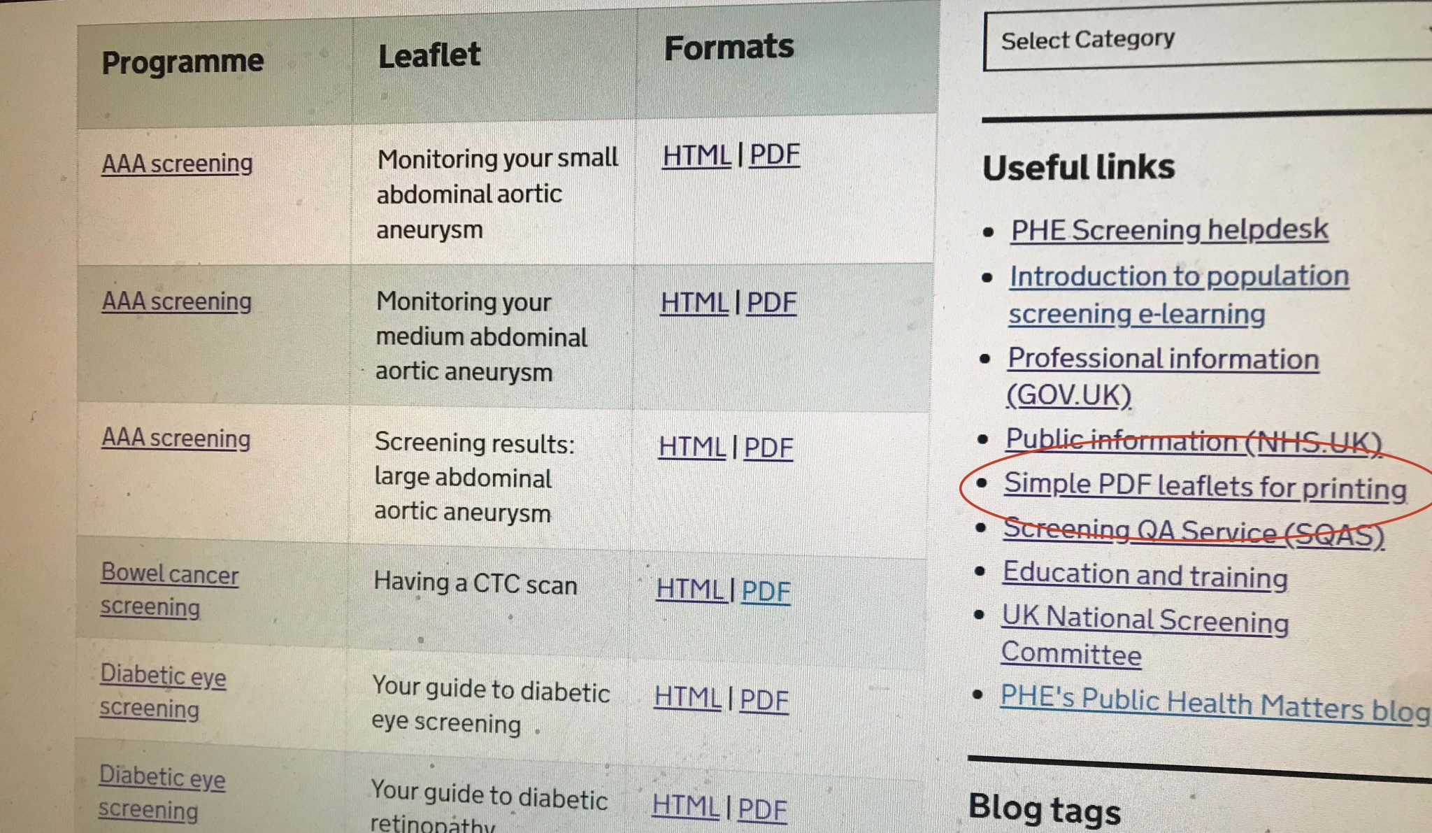 NHS Abdominal Aortic Aneurysm Screening Programme – PHE Screening