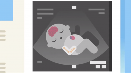 Updated national FASP screening standards published – PHE Screening