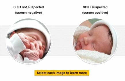 Liane Powell – PHE Screening